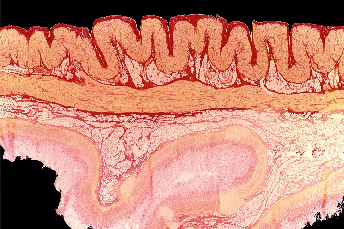 Picture of the month: Microstructure of the stomach wall - The key to ...